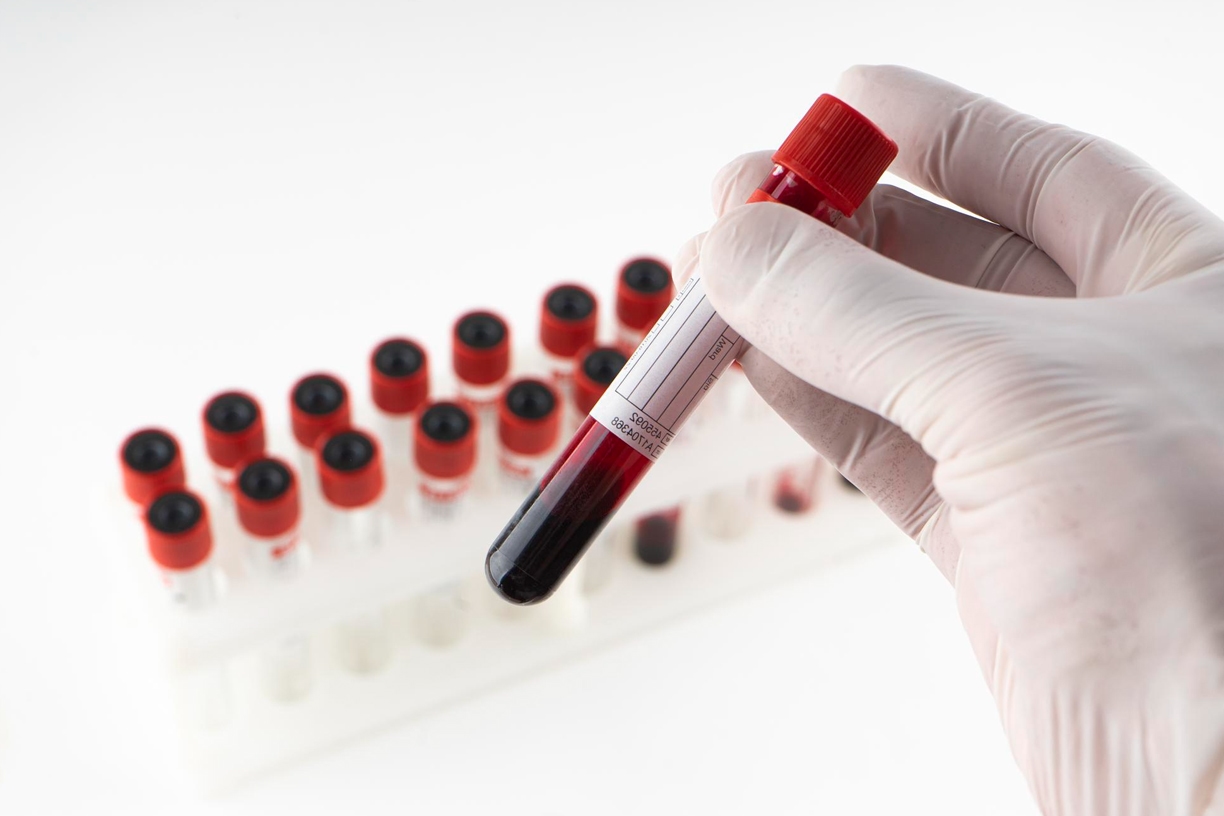 Blood Builder Treatment in Dubai | YAH Polyclinic